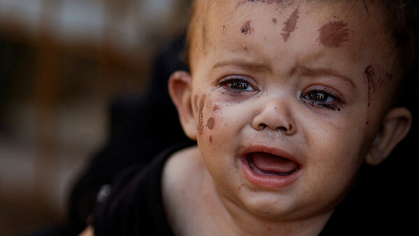 Gaza Children Losing Hope in Life